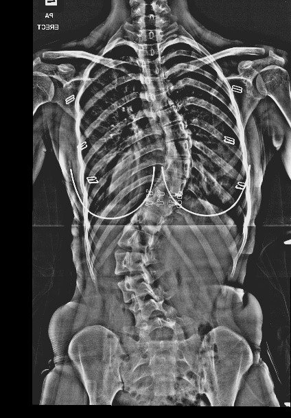 Education – cyriaxphysio