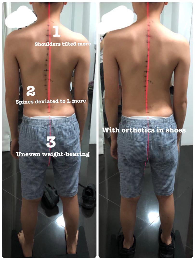 Case Study – cyriaxphysio