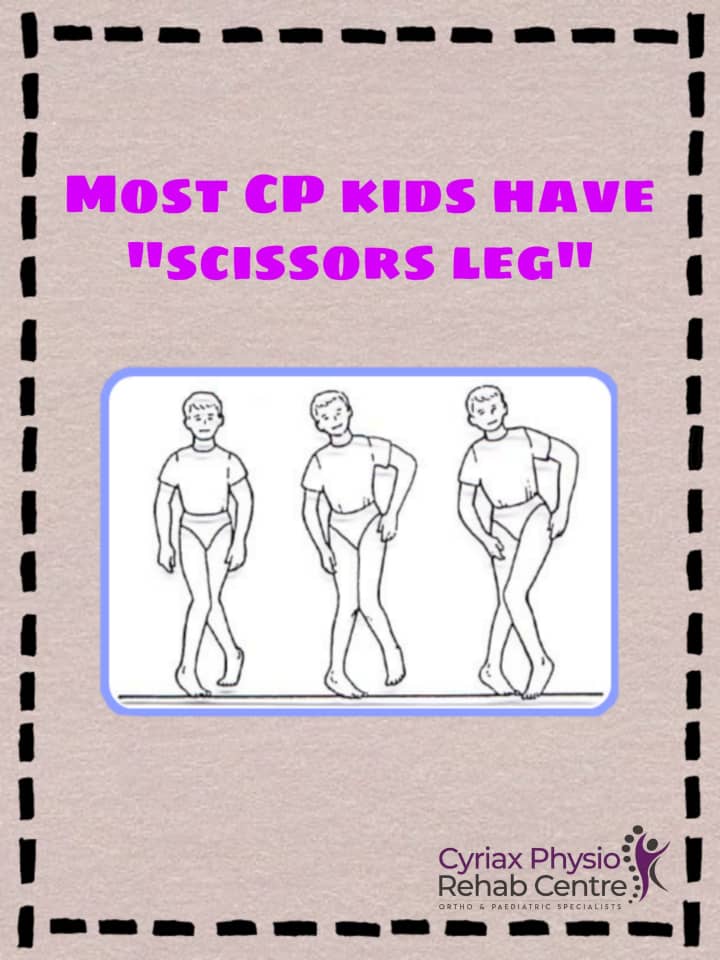 How To Carry Cerebral Palsy Kids? – cyriaxphysio