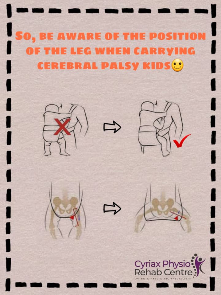 How To Carry Cerebral Palsy Kids? – cyriaxphysio